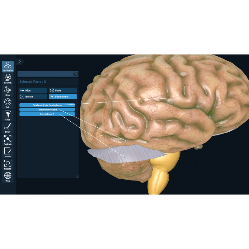 3D Organon for your desktop | Standard